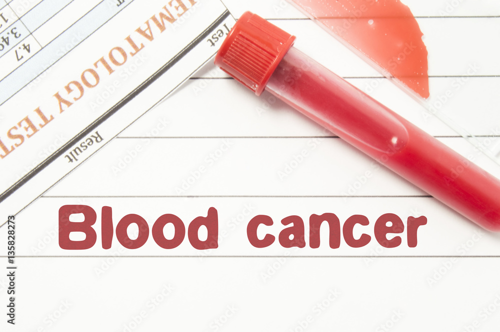 Diagnosis Blood Cancer. Notepad with text labels Blood Cancer ...