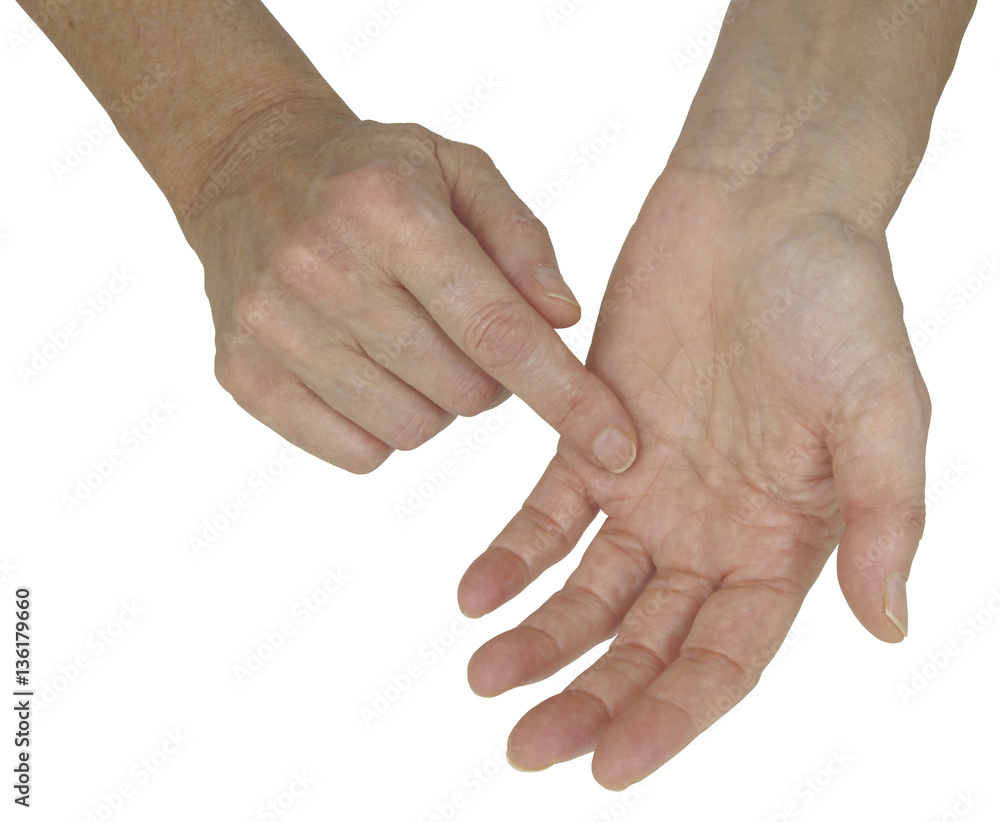 And here is the Sun Line on the Mount of Apollo - Palm reader pointing ...