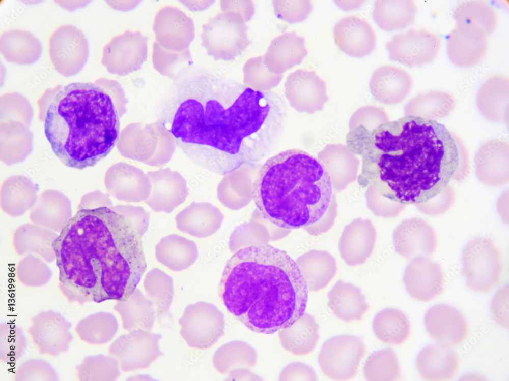 White blood cells in blood smear, Wright stain Stock Photo | Adobe Stock