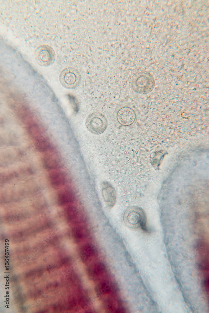 Gills of fish ,protozoa and Trichodina spp. under the microscope.(soft ...