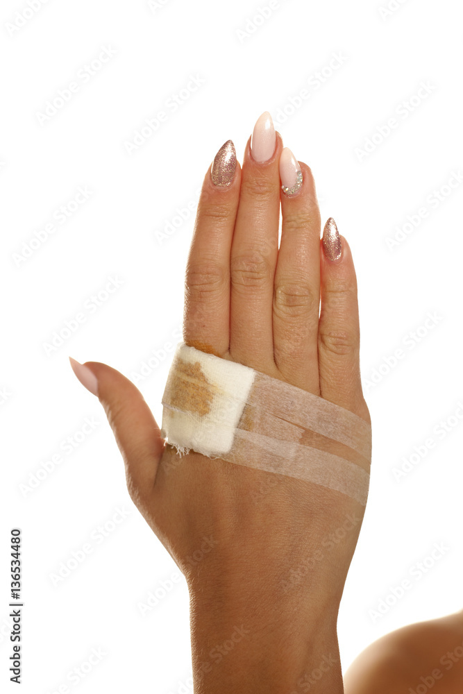 female injured hand wrapped with a bandage Stock Photo | Adobe Stock