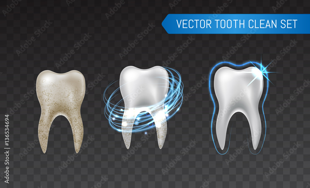 Vector set of 3d realistic clean and dirty tooth isolated on ...
