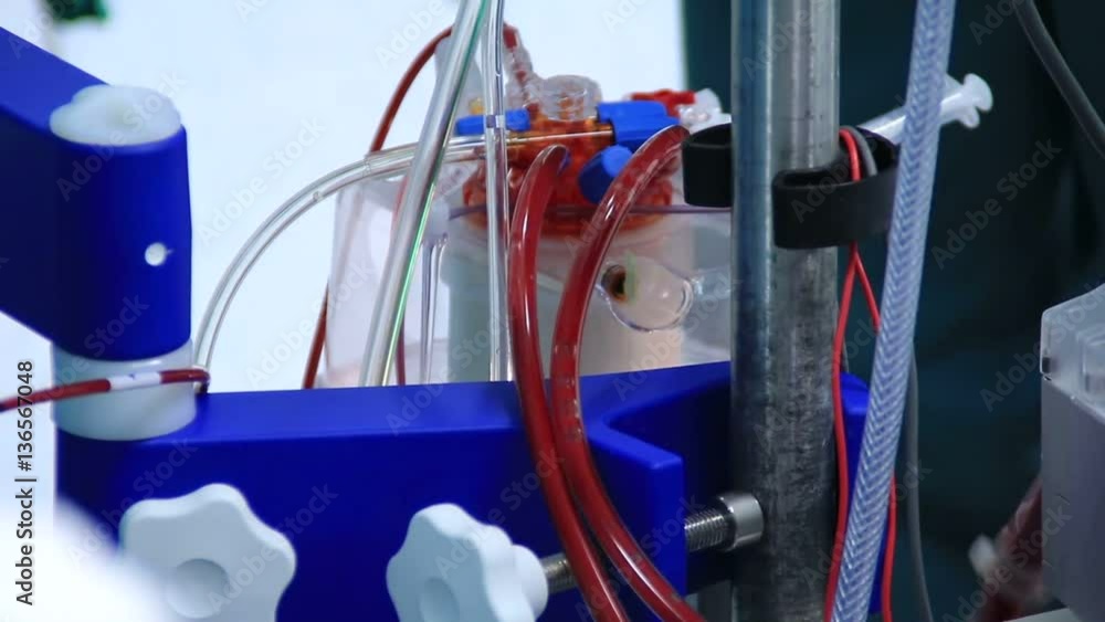 Heart lung machine pumping blood in operating room Stock Video | Adobe ...