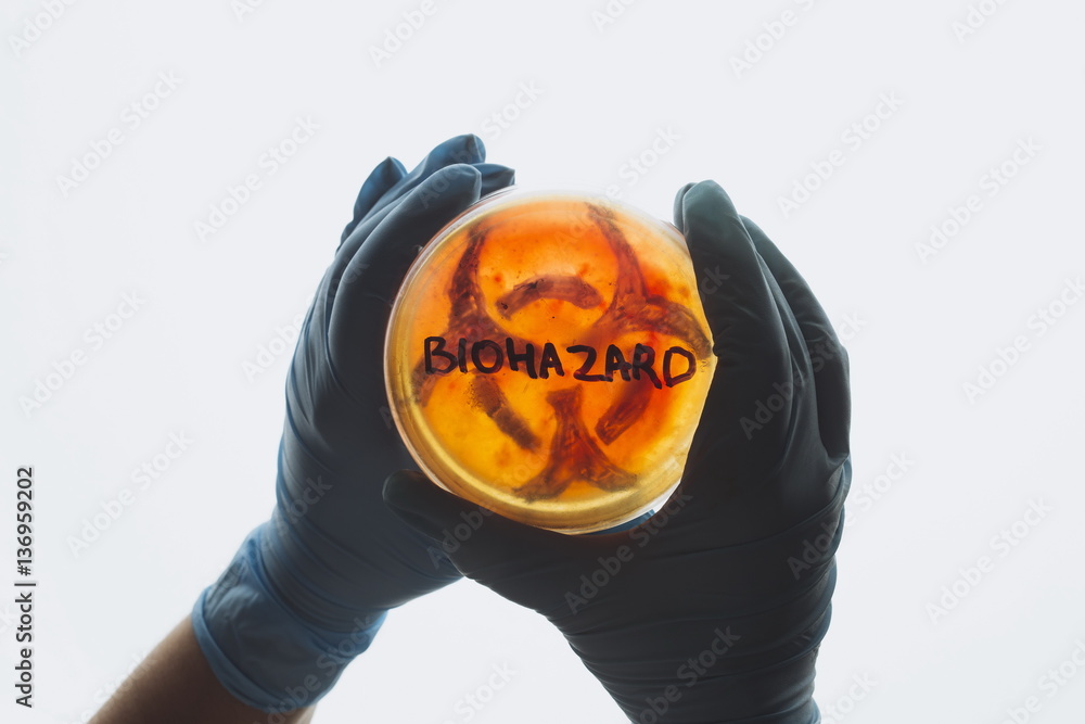 Hands hold Petri dish with biohazard symbol sign. Contaminated water ...