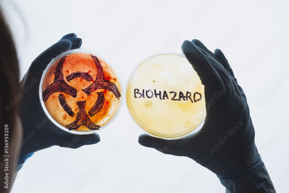 Hands hold Petri dishes with biohazard word symbol sign. Contaminated ...