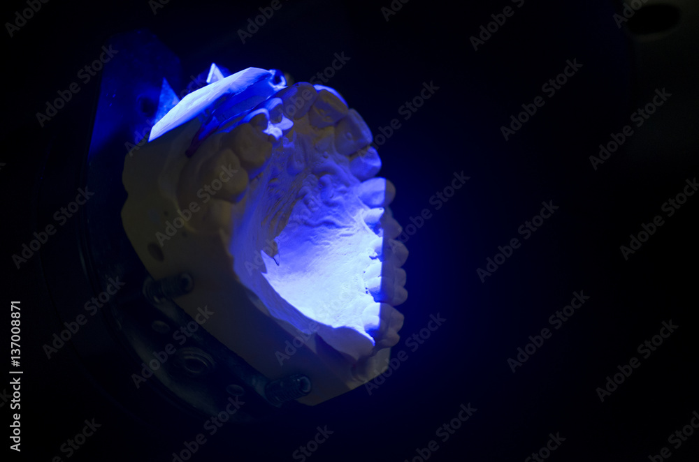 Dental technician scanning a dental cast model in a 3D surface s Stock ...