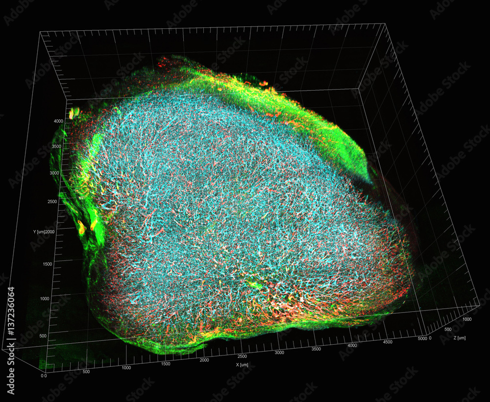 Transparent tumor tomography visualising tumor microenvironment ...