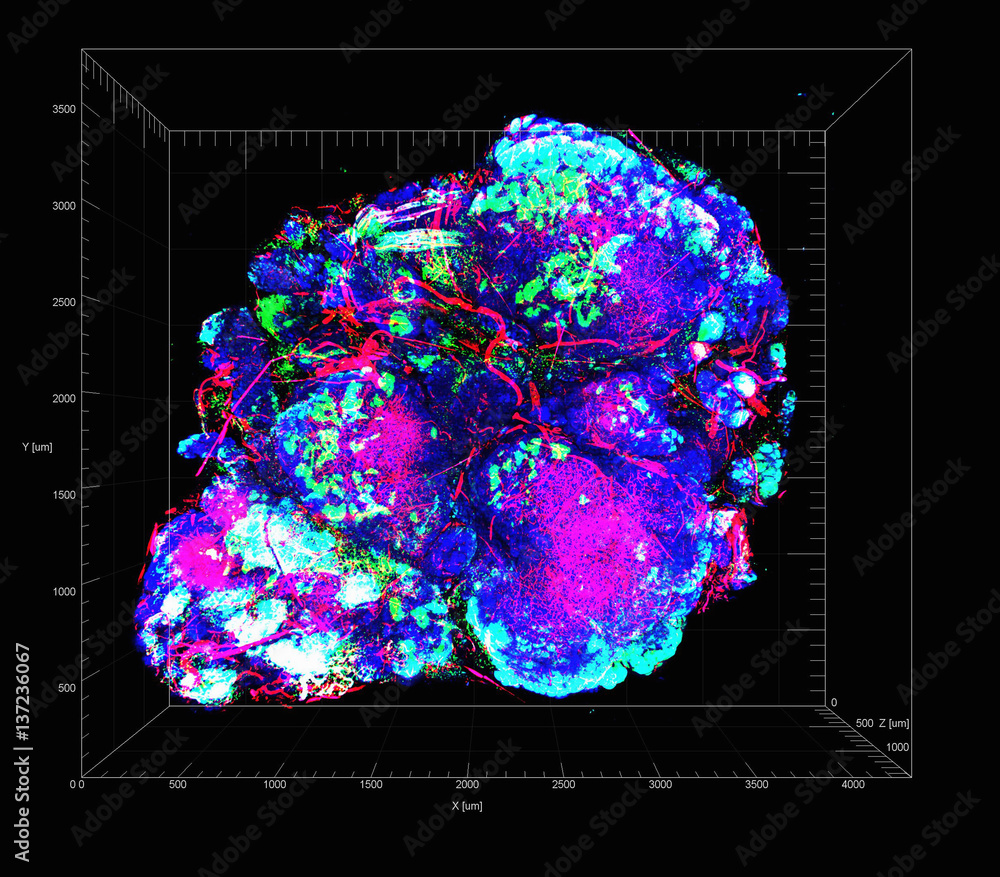Transparent tumor tomography visualising tumor microenvironment ... Transparent tumor tomography visualising tumor microenvironment ...