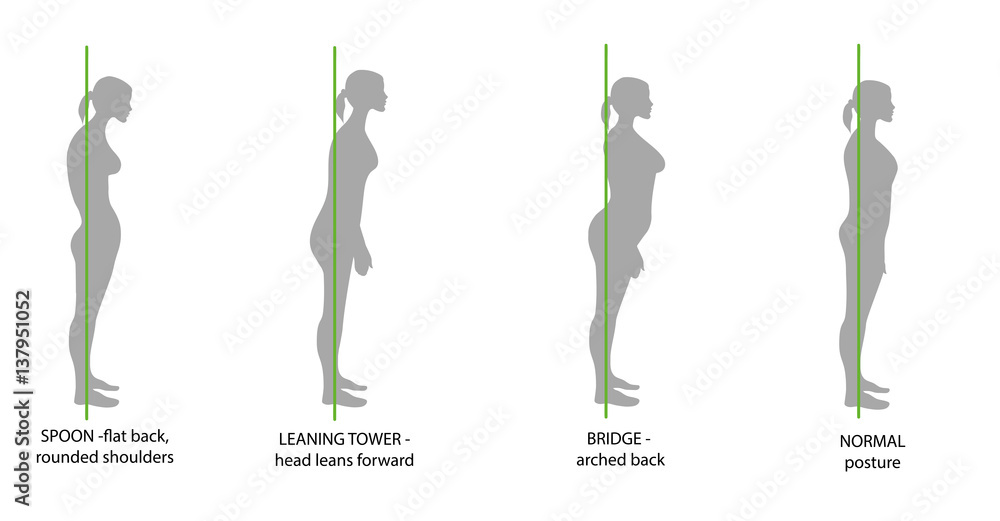 silhouette of women with correct and incorrect posture. vector ...