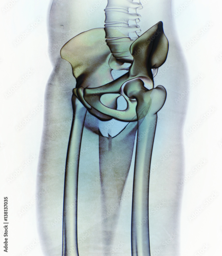 Ilium bone, hip bone or pelvis. Human anatomy, bone skeletal strucure ...