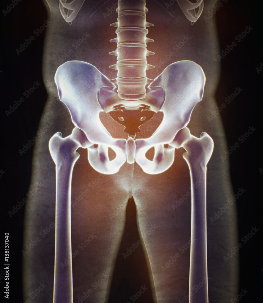 Ilium bone, hip bone or pelvis. Human anatomy, bone skeletal strucure ...