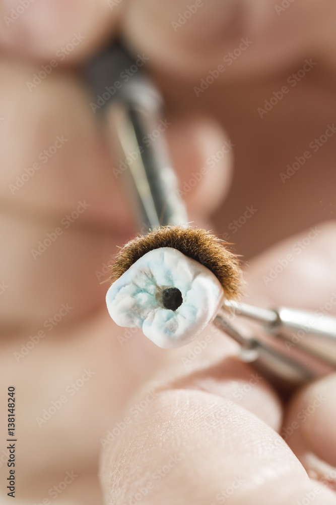 Dental prosthesis, artificial tooth, prosthetic, hands working on the ...