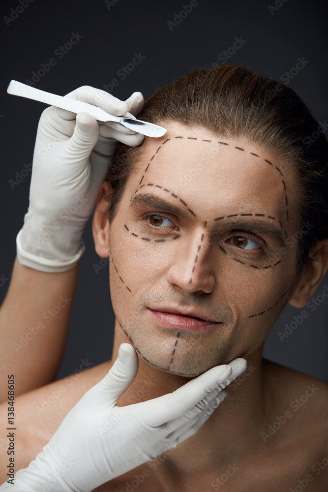 Man With Black Lines On Face Before Plastic Surgery Operation Stock ...