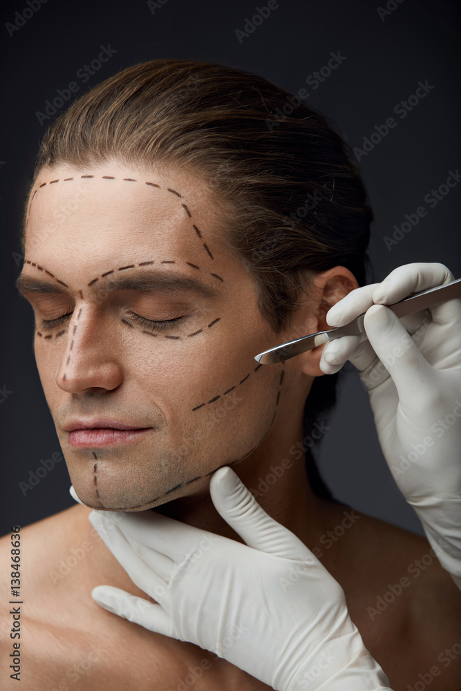 Man With Black Lines On Face Before Plastic Surgery Operation Stock