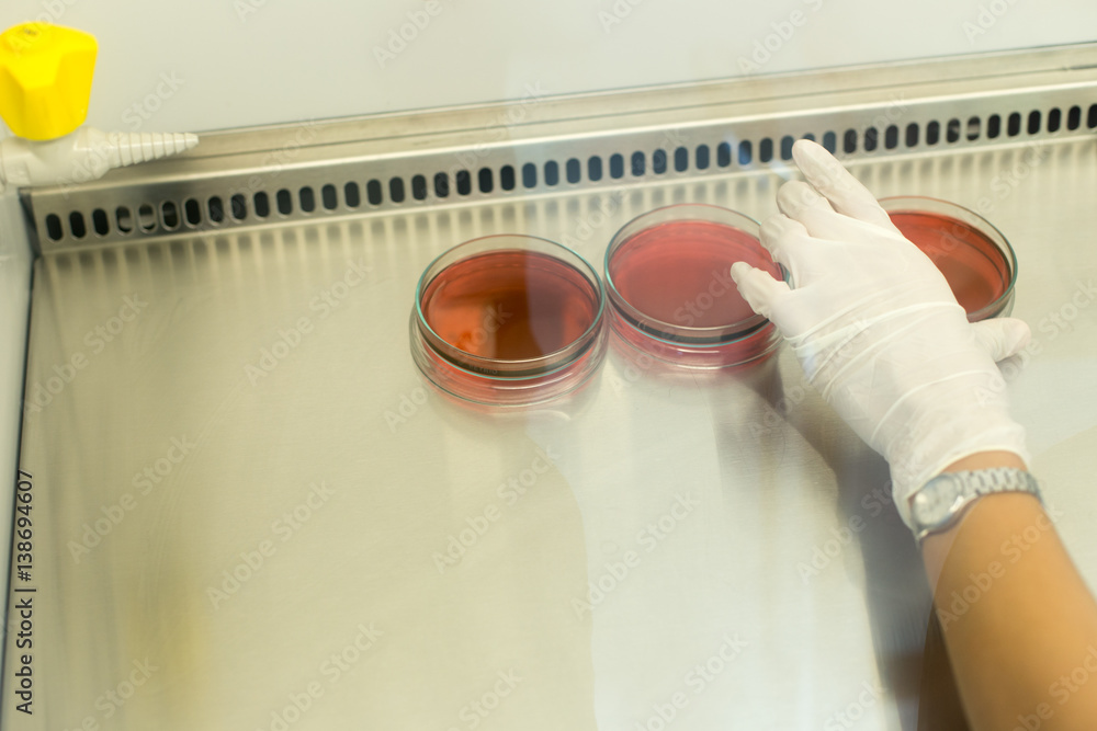 Eosin Methylene Blue (EMB) Agar for culture medium for Inoculum tests ...