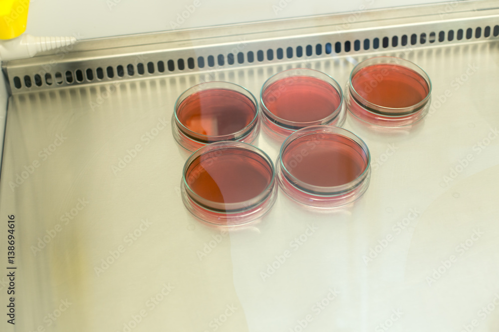 Eosin Methylene Blue (EMB) Agar for culture medium for Inoculum tests ...