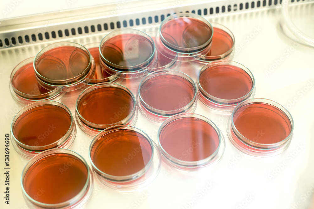 Eosin Methylene Blue (EMB) Agar for culture medium for Inoculum tests ...