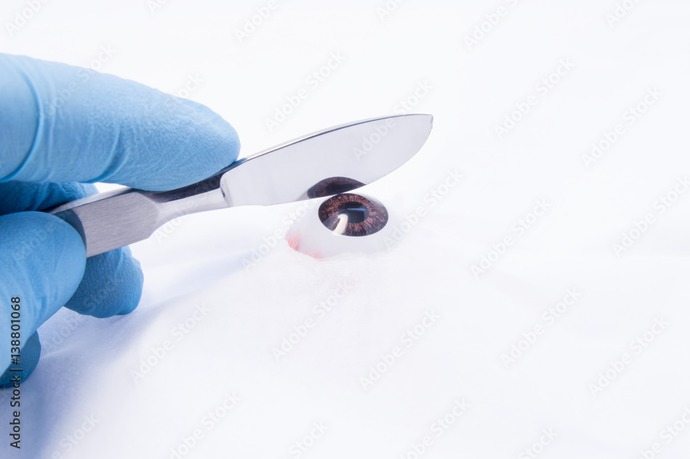 Concept photo of eye surgery. Eye surgeon holding scalpel over model of ...
