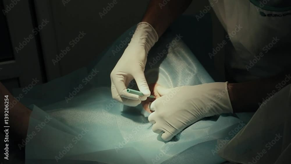 The surgeon makes an operation on his leg. Doctor doing a biopsy on the ...