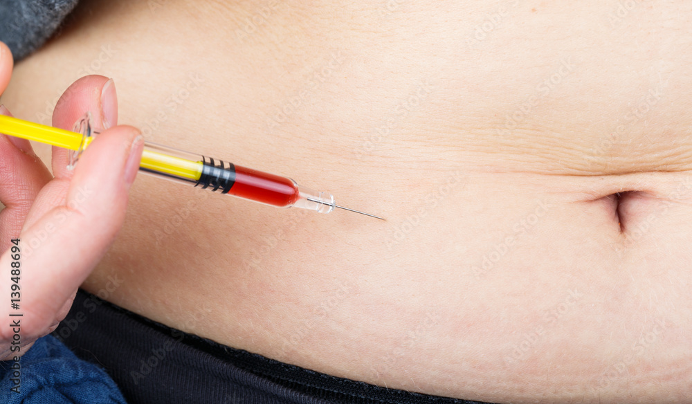Abdominal insulin injection Stock Photo | Adobe Stock