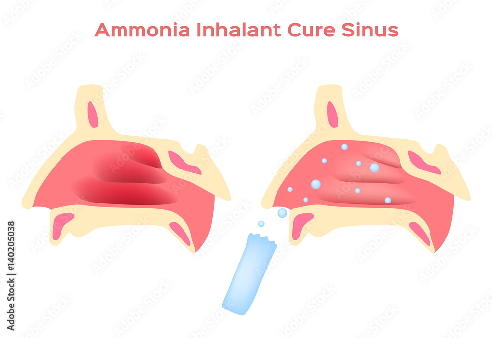 Ammonia Inhalant cure nasal cavity Stock Vector | Adobe Stock