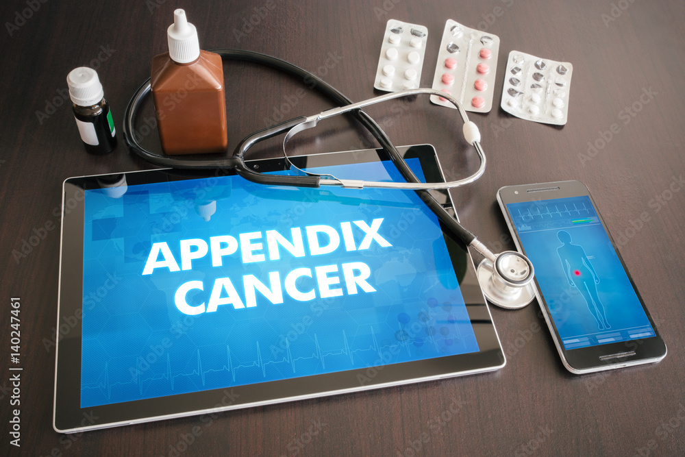 Appendix cancer (cancer type) diagnosis medical concept on tablet ...