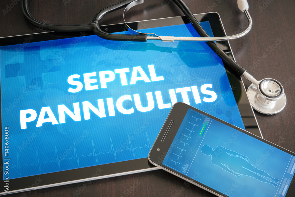 Septal panniculitis (cutaneous disease) diagnosis medical concept on ...