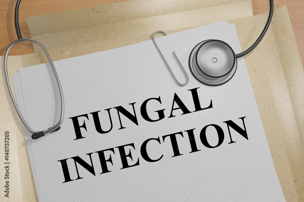 Fungal Infection - medical concept Stock Illustration | Adobe Stock