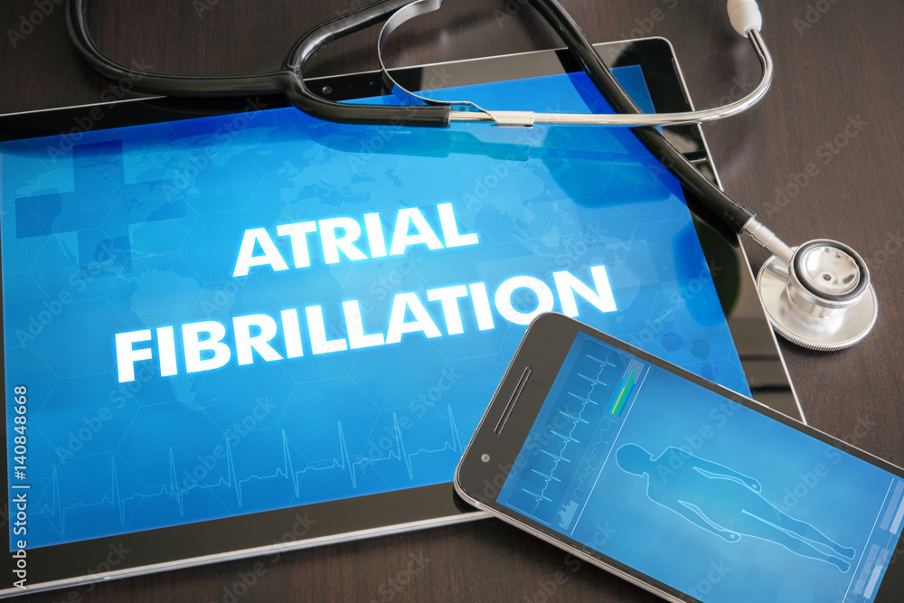 Atrial fibrillation (heart disorder) diagnosis medical concept on ...