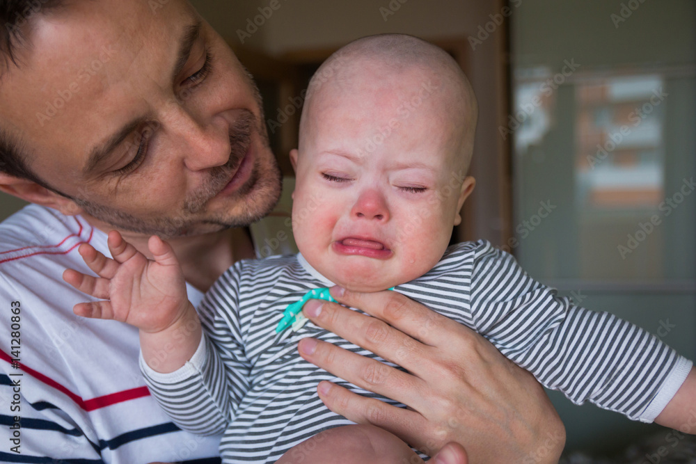 Cute baby boy with Down syndrome crying Stock 写真 | Adobe Stock