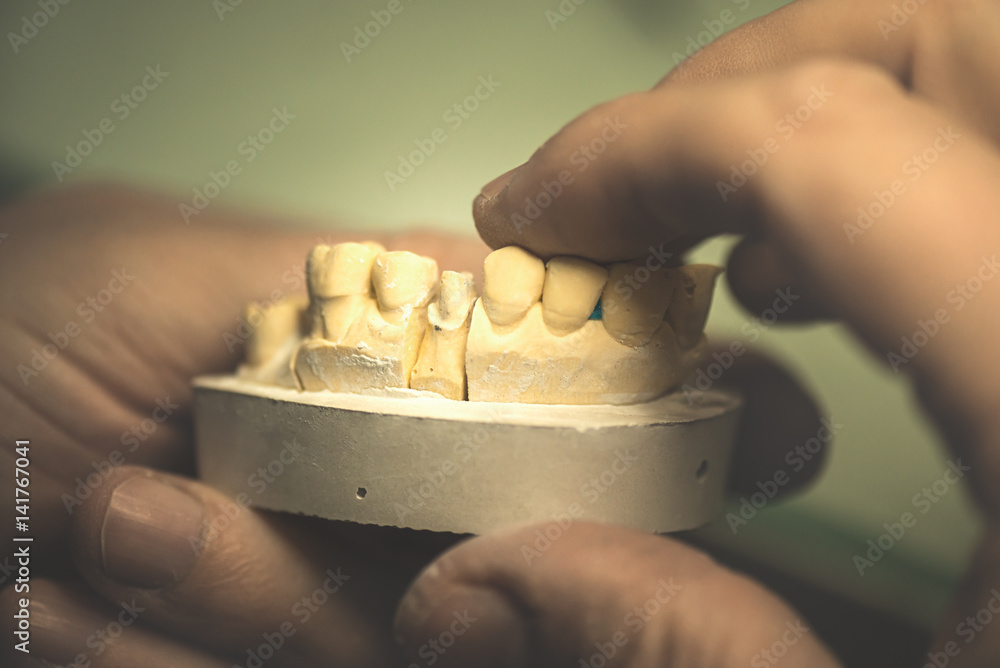 Dental prosthesis, artificial tooth, prosthetic, hands working on the ...