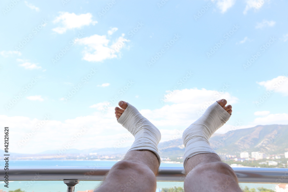 Broken legs in plaster Stock Photo | Adobe Stock