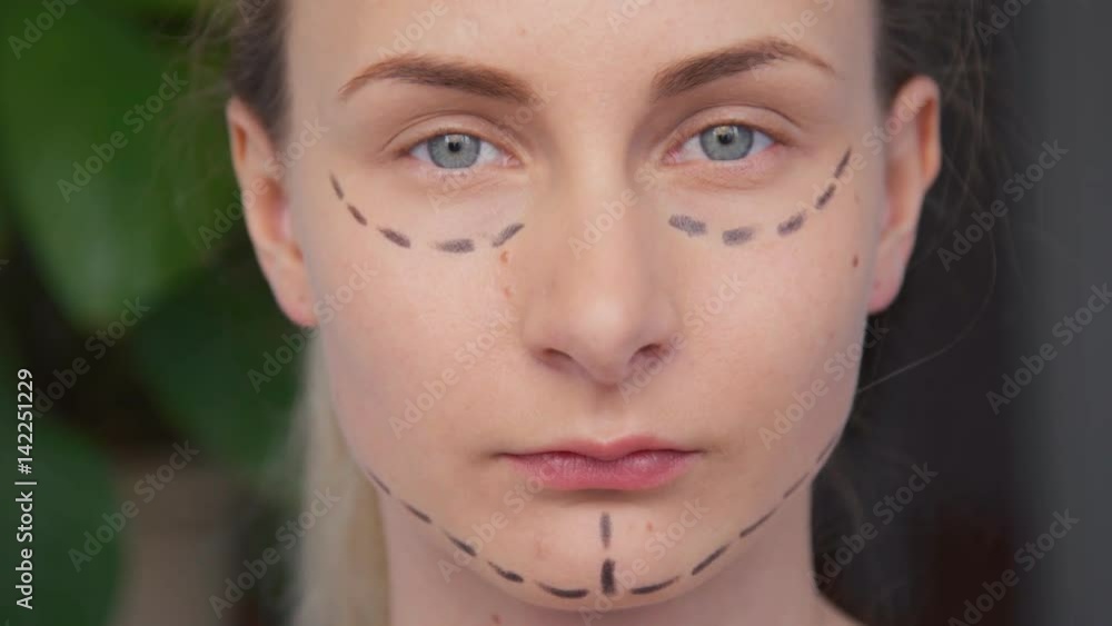 woman plastic surgery markings on face 素材庫影片 | Adobe Stock