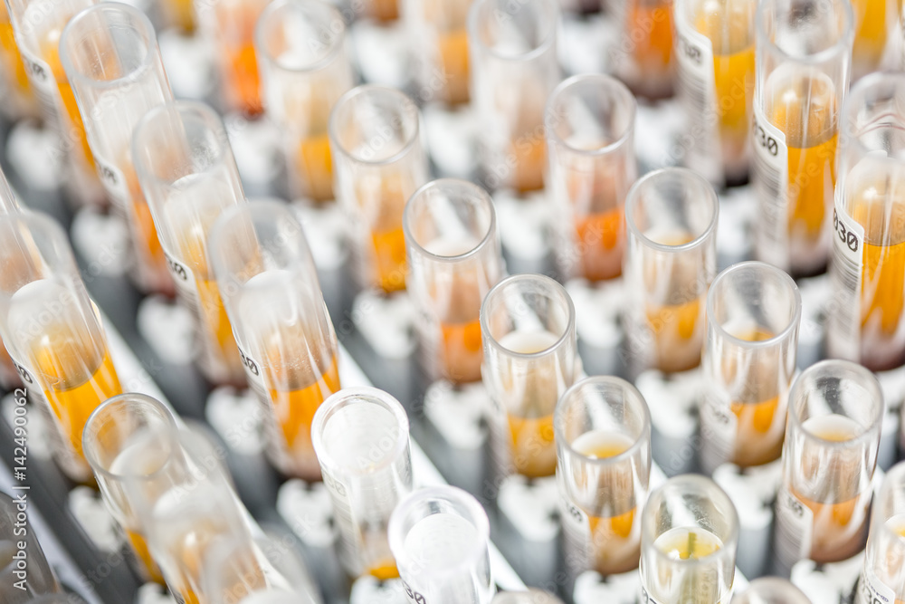 Laboratory glass test tubes filled with orange liquid for an experiment ...