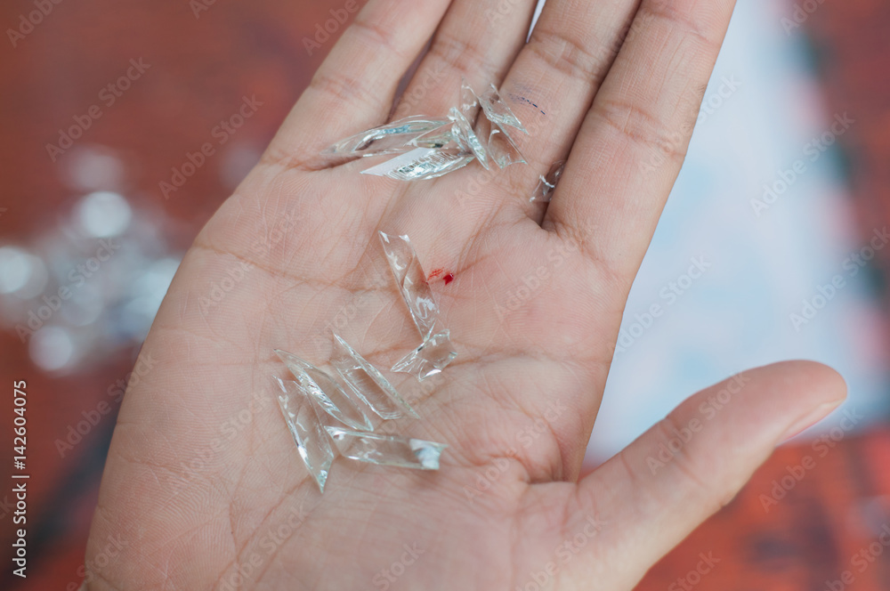 Cuts On Skin From Glass