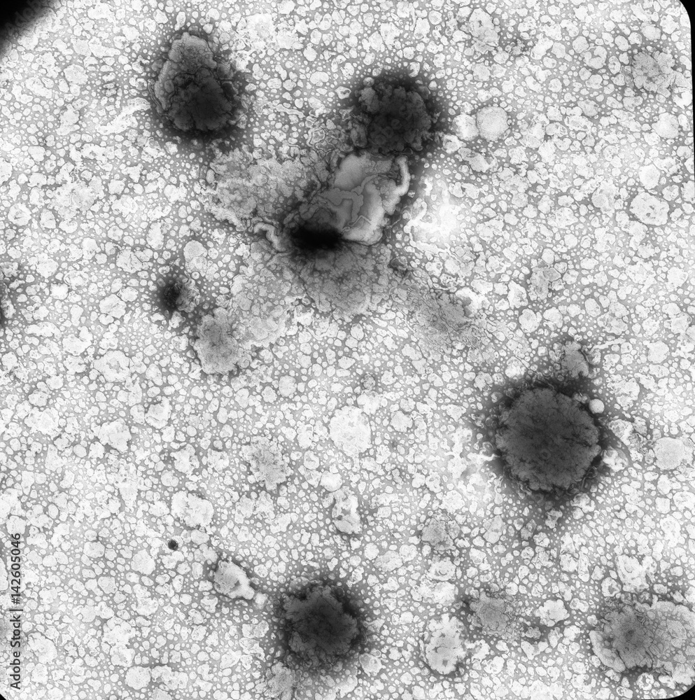 Liposomi osservati al microscopio elettronico foto de Stock | Adobe Stock