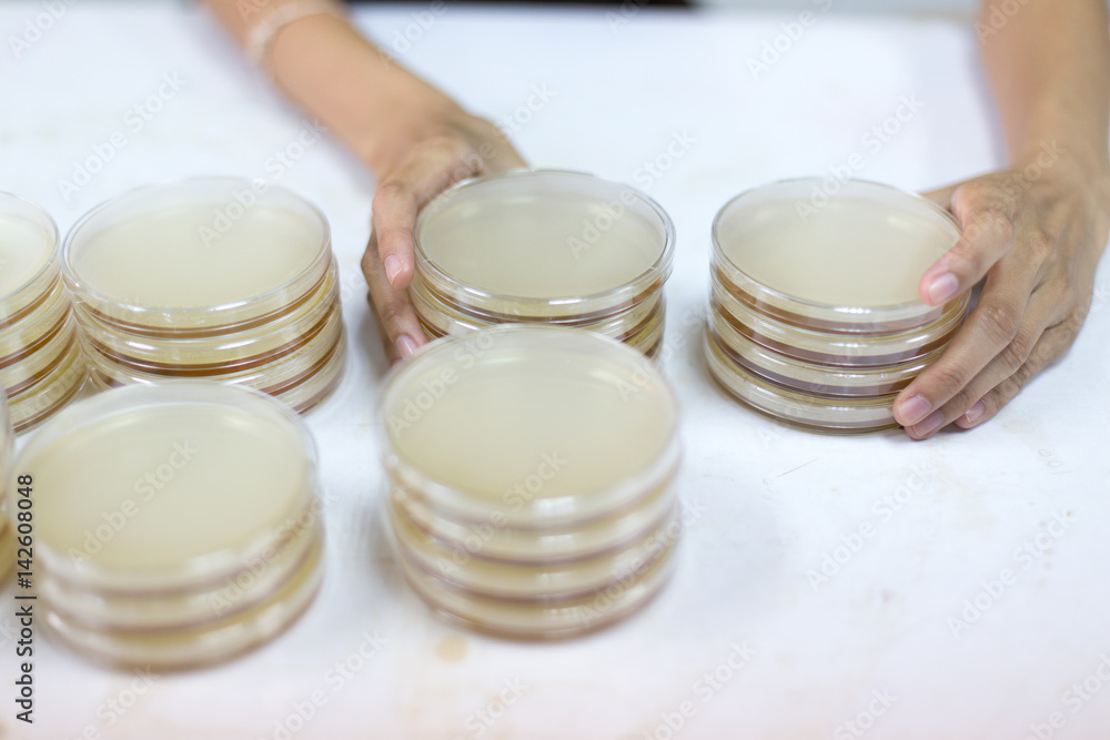 Eosin Methylene Blue (EMB) Agar for culture medium for Inoculum tests ...