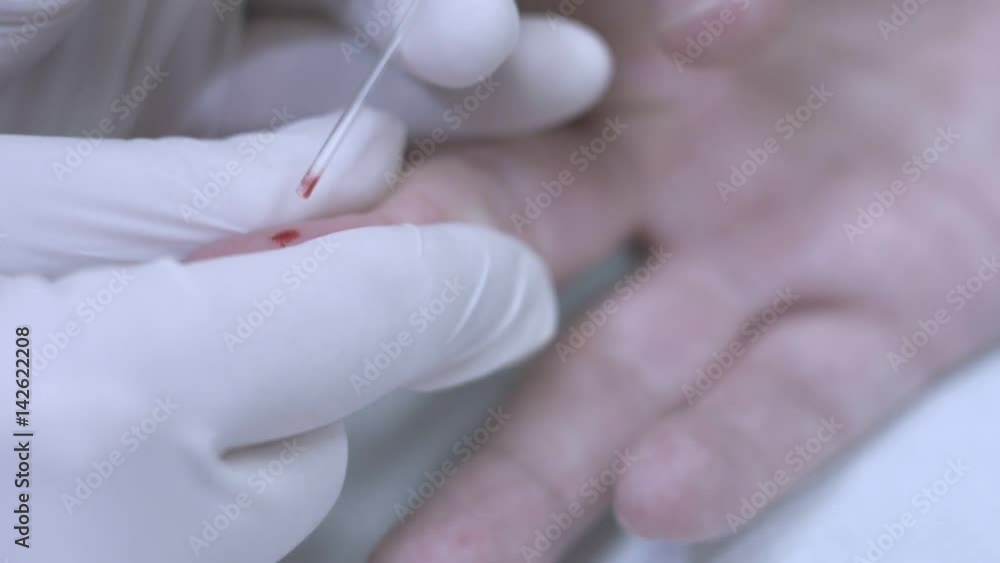 Draw blood finger. Close up of taking blood sample from finger. Finger ...
