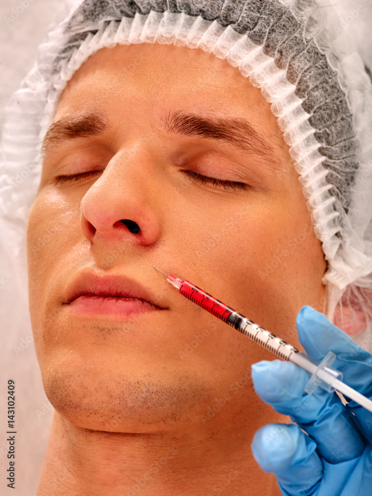 Filler injection for male forehead face. Plastic aesthetic facial ...