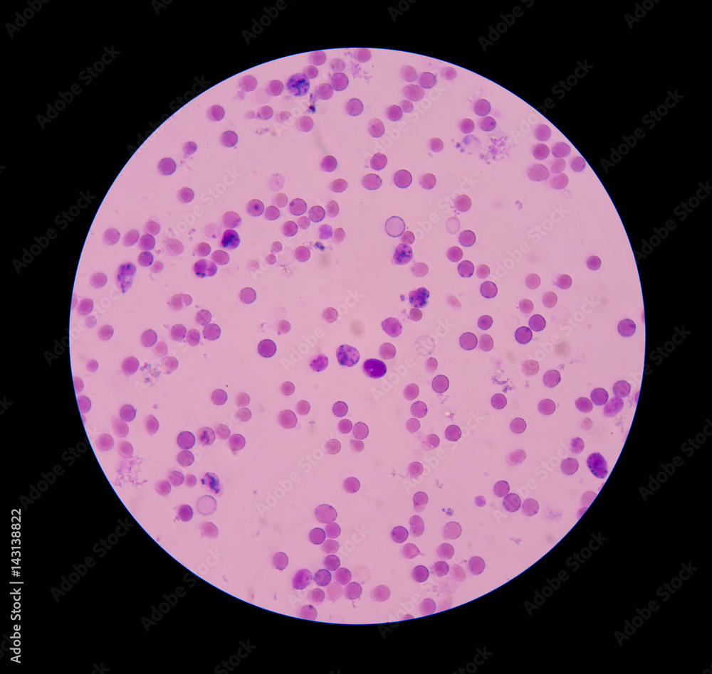 Foto de Reticulocyte with red blood cells on blood smear. do Stock ...