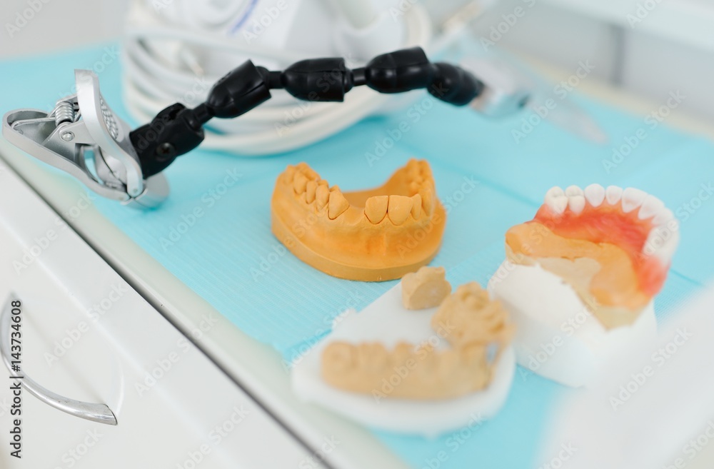 Gypsum models of dentures on the table close-up. Dental prosthetics ...