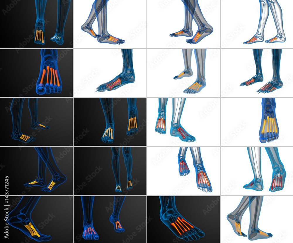 Photo & Art Print 3d rendering medical illustration of the metatarsal ...