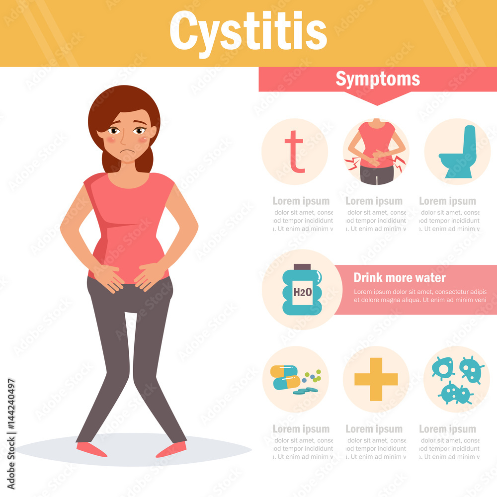Cystitis. Isolated art Stock Illustration | Adobe Stock