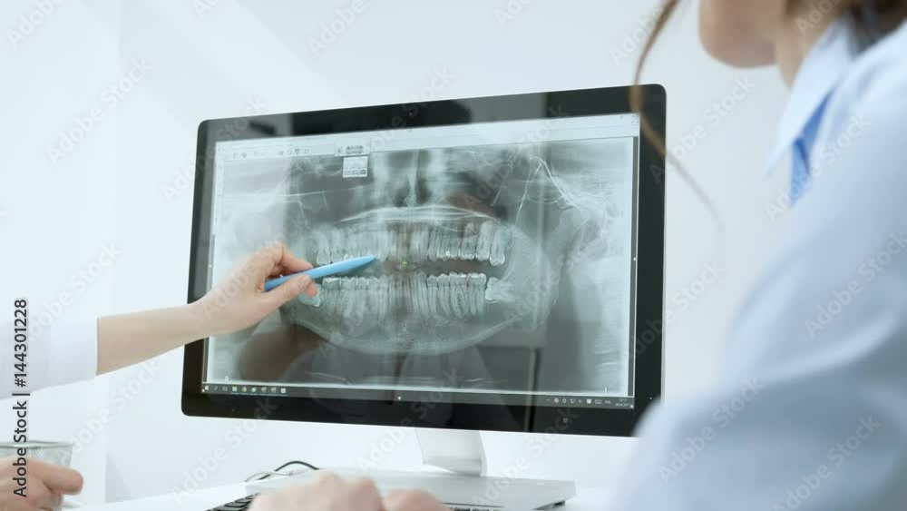 Doctor shows your patient the situation of her teeth. Doctor giving ...