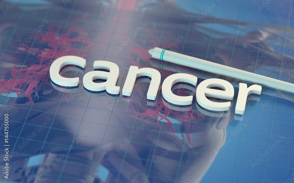 The word "cancer" on a reflective digital surface with anatomical ...