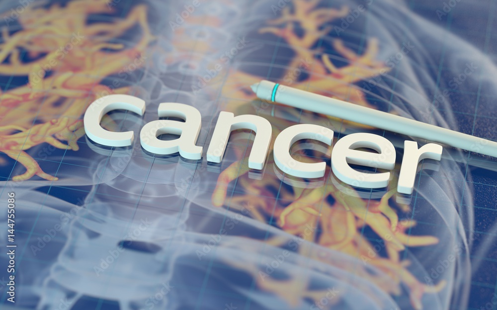 The word "cancer" on a reflective digital surface with anatomical ...