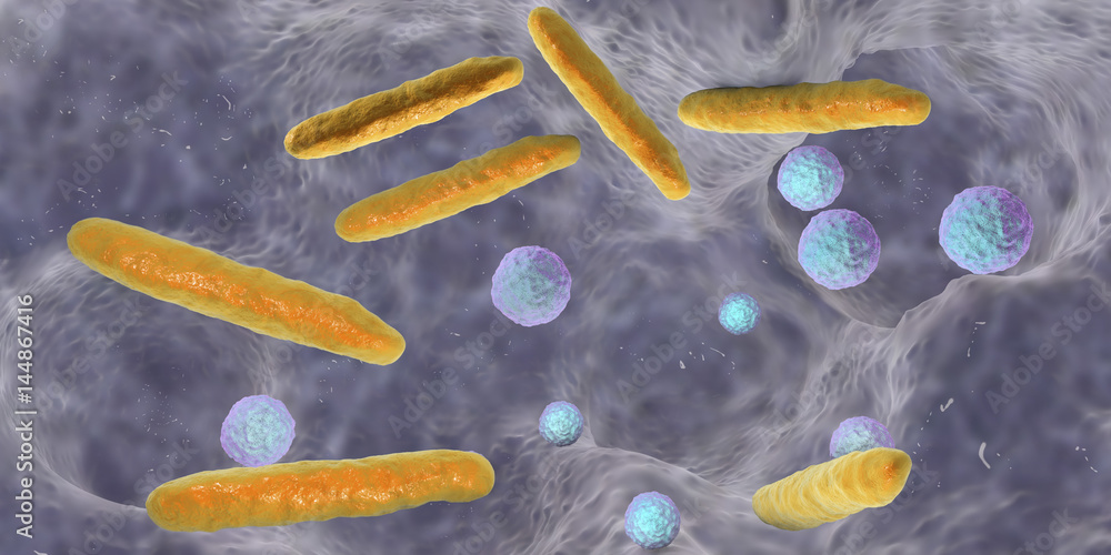 Bacteria inside dental cavity, dental decay. Tooth caries bacteria, 3D ...