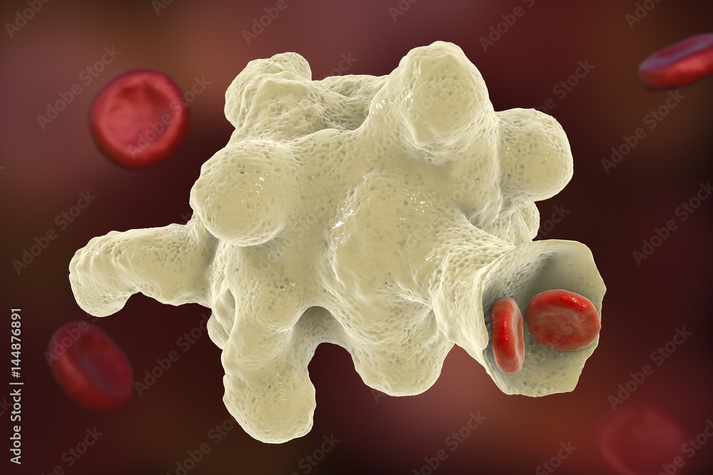 Entamoeba histolytica protozoan engulfing red blood cells. Parasite ...