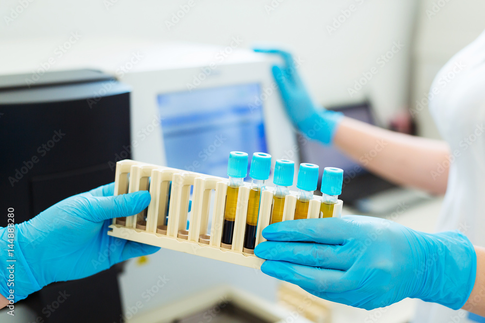 Hands of laboratory assistant loading sample tubes for coagulation test ...