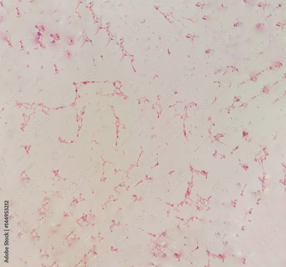 Smear of human blood cultured Gram's stained under 100X light ...